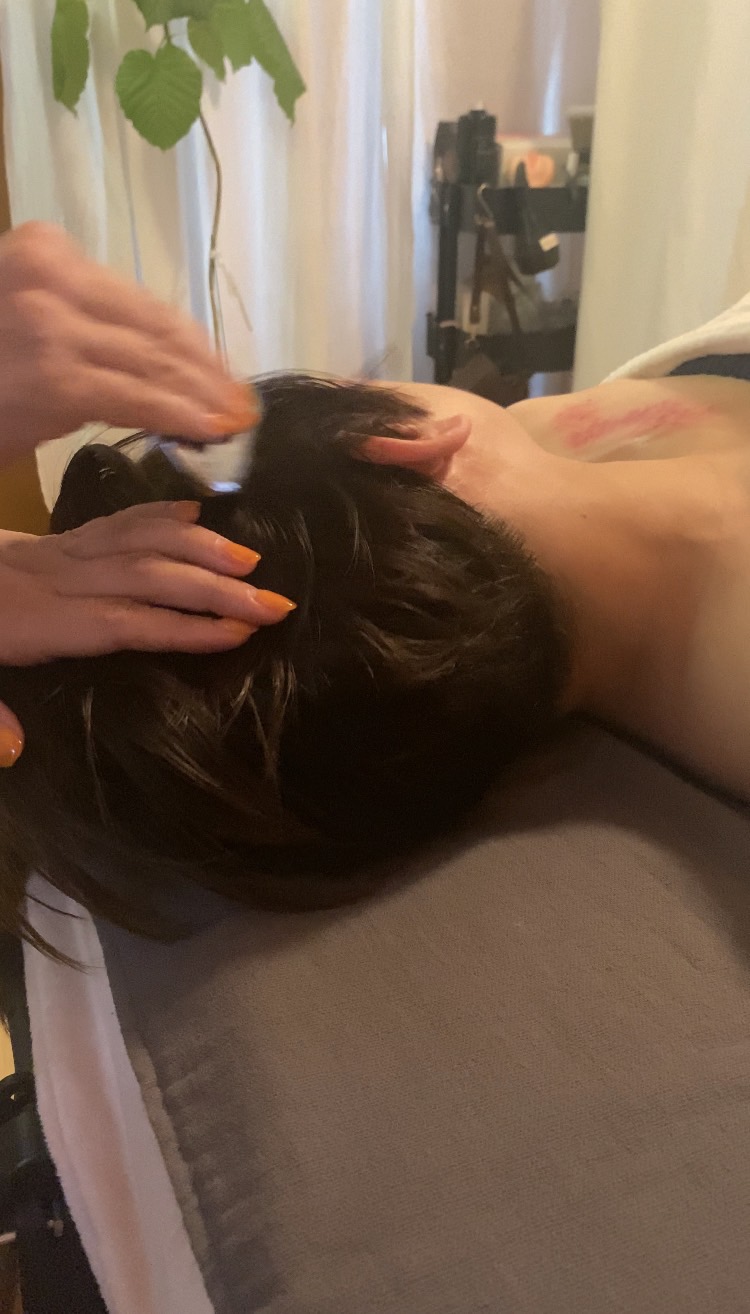 カッピングやよもぎ蒸しでココロもカラダも穏やかに♪ プライベートサロン「yuruc」久留米市 - WeeeeKS - ウィークス